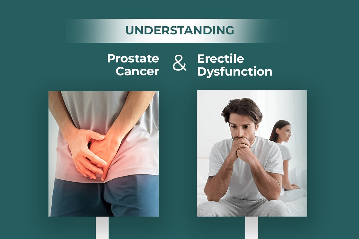 Understanding Prostate Cancer and Erectile Dysfunction – Bionutrica